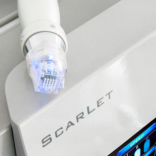 RF-терапия на аппарате Scarlet RF: исследование эффективности | Портал ...